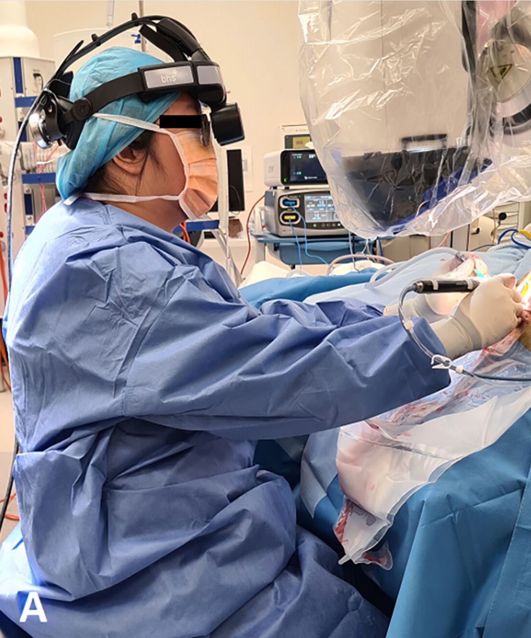 Improving Surgical Ergonomics with the RoboticScope